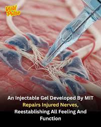 Revolutionizing Nerve Repair: MIT’s Injectable Gel Offers New Hope for ...