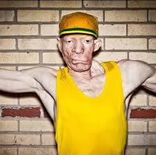 Yellowman Gives His Two Sense ‘King of Dancehall’ Saga – Radio Dubplate