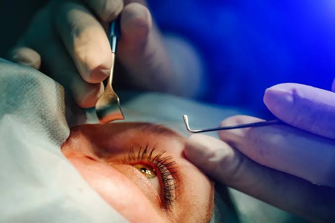 Refractive Cataract Surgery: From Preoperative Evaluation to ...