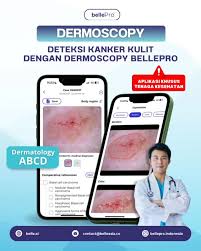 Dermatoscopy AI: Analisis Lesi Kulit dengan Kecerdasan Buatan - Tech It