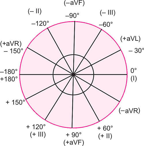 VECTORIAL ANALYSIS OF ECG | Austin Tommy