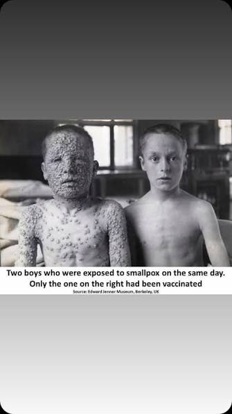“A Photograph That Changed Medicine — The Two Boys Who Proved What ...