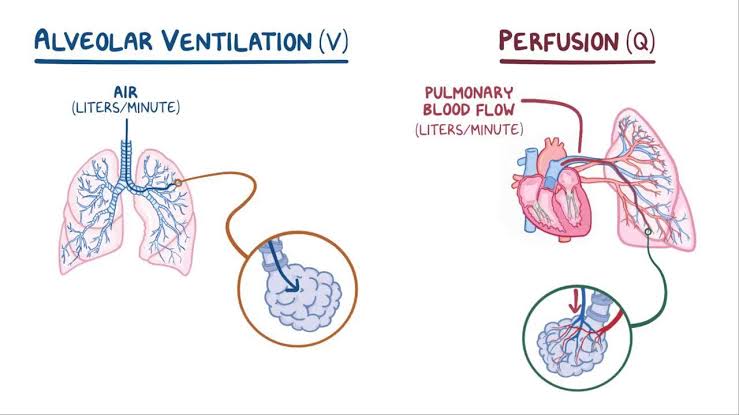 A COMPREHENSIVE GUIDE TO VENTILATION-PERFUSION RATIO | Austin Tommy