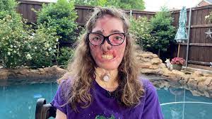 Jacqueline Durand: A Survivor’s Journey of Resilience, Recovery, and ...