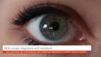 Why Do My Contact Lenses Cause Discomfort?